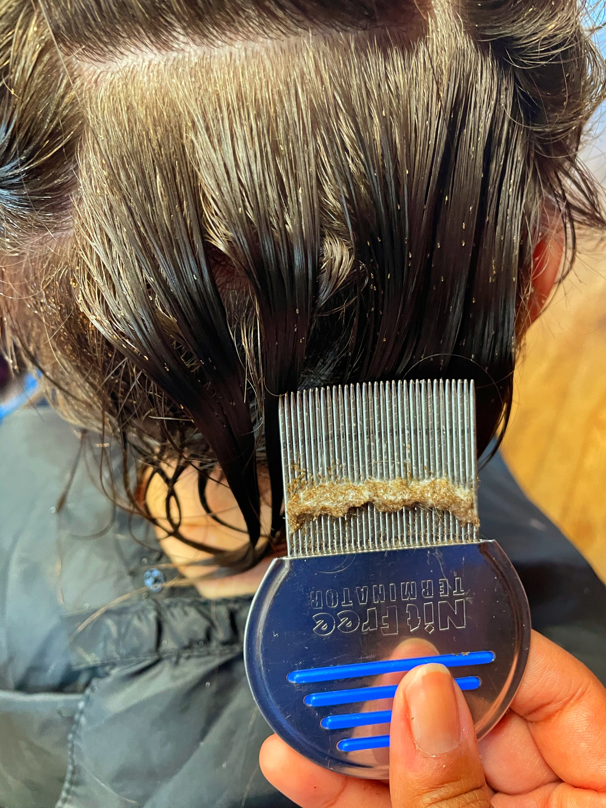 Terminator Lice Comb The Louse Girl Mobile Head Lice Removal Service